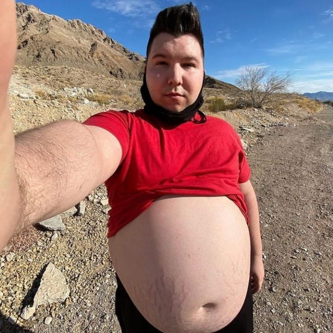 Nikocado Avocado's Weight, Death Rumors And Husband Split